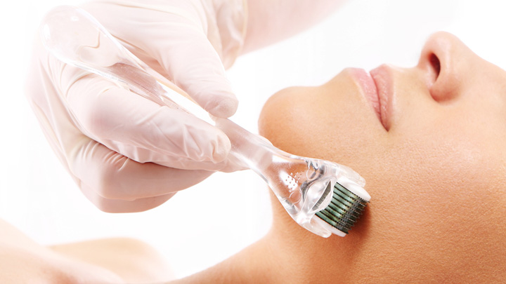 Skin needling: All you need to know - Starts at 60