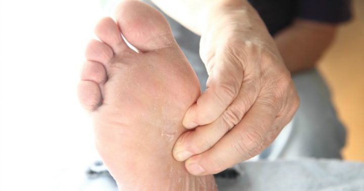 Why you should examine the bottom of your feet - Starts at 60