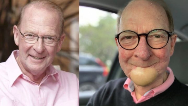 John Blackman gives health update just days after latest cancer surgery ...