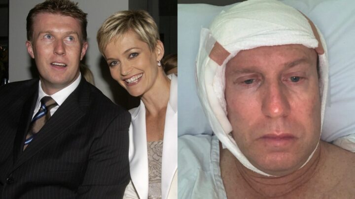 ‘A little battered and bruised’: Peter Overton shares gruesome health ...