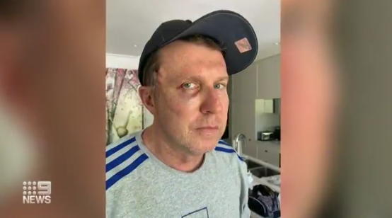 Peter Overton shows off melanoma surgery scar live on air - Starts at 60