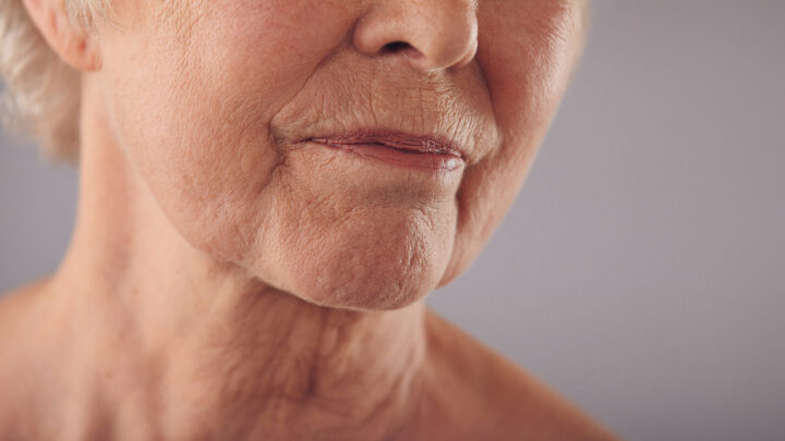 Solutions to common age-related skin conditions - Starts at 60
