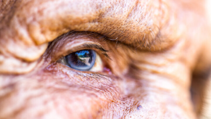 Why the colour of our eyes can change as we age - Starts at 60